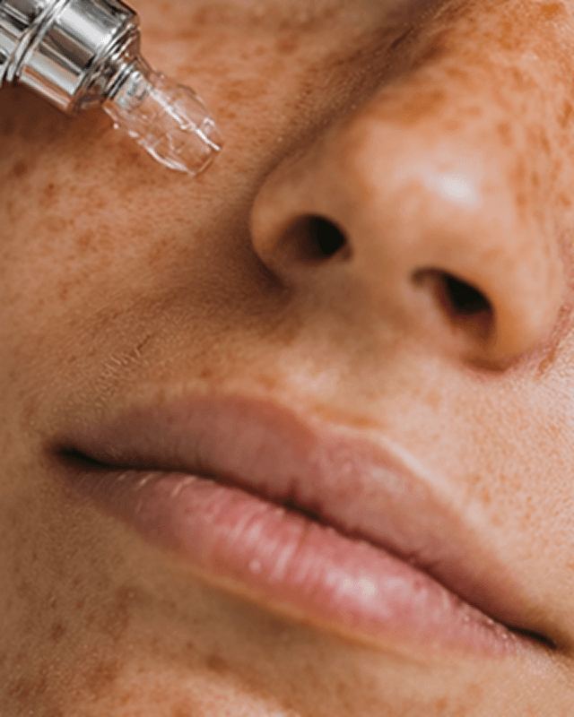 Skin boosters in West didsbury, Manchester | Top Clinics, Reviews ...